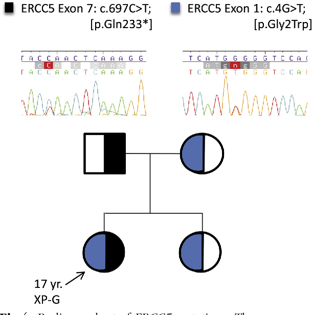 Figure 1 From Novel Germline Ercc5 Mutations Identified In A Xeroderma