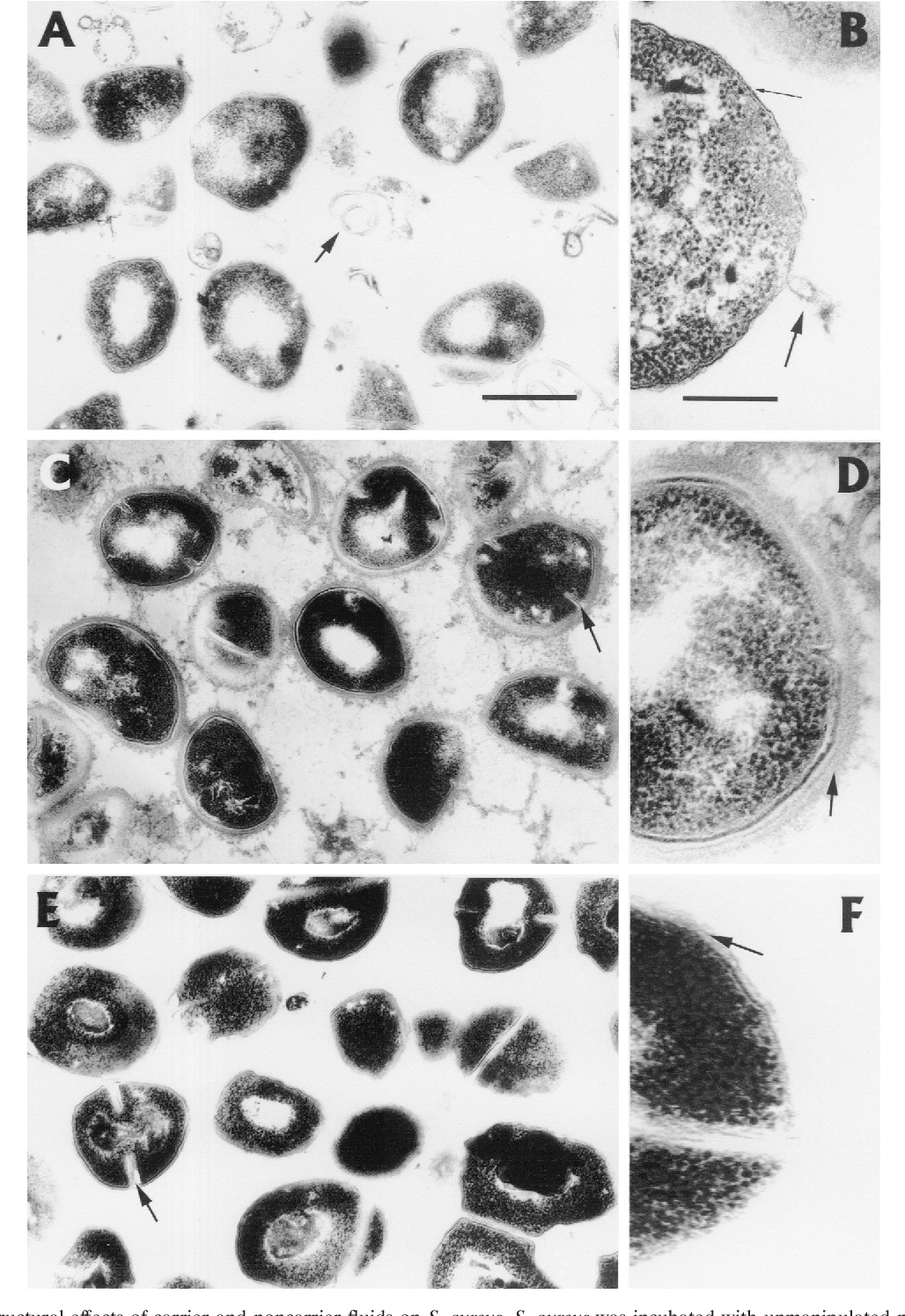 Pdf Determinants Of Staphylococcus Aureus Nasal Carriage Semantic