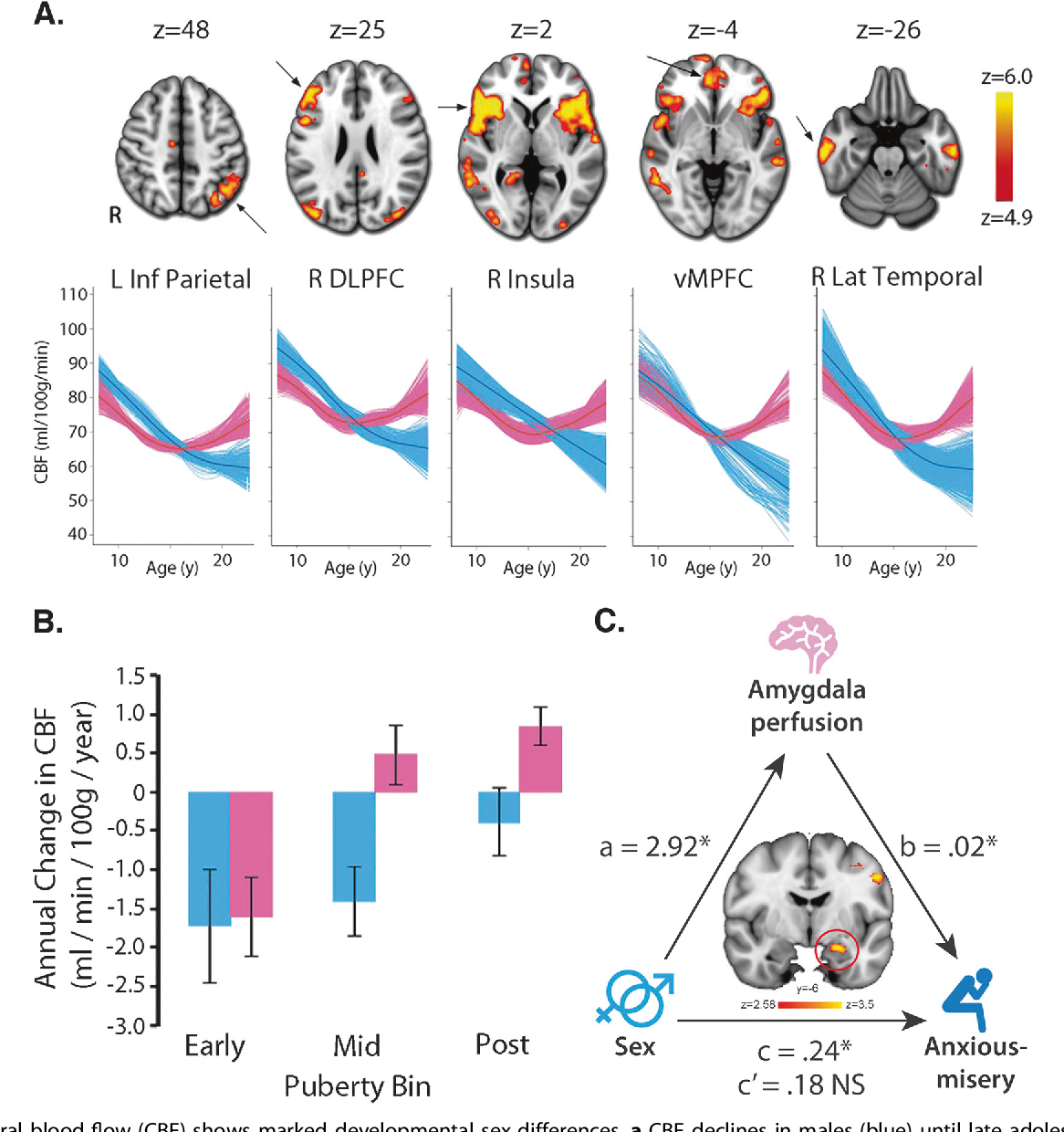 Pdf Sex Differences In The Developing Brain Insights From Multimodal