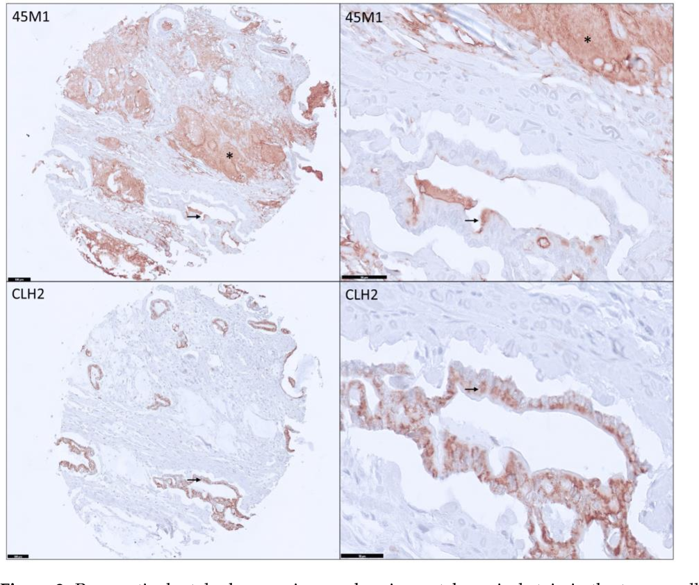 Figure 2 From Differential Expression And Diagnostic Value Of Muc5ac