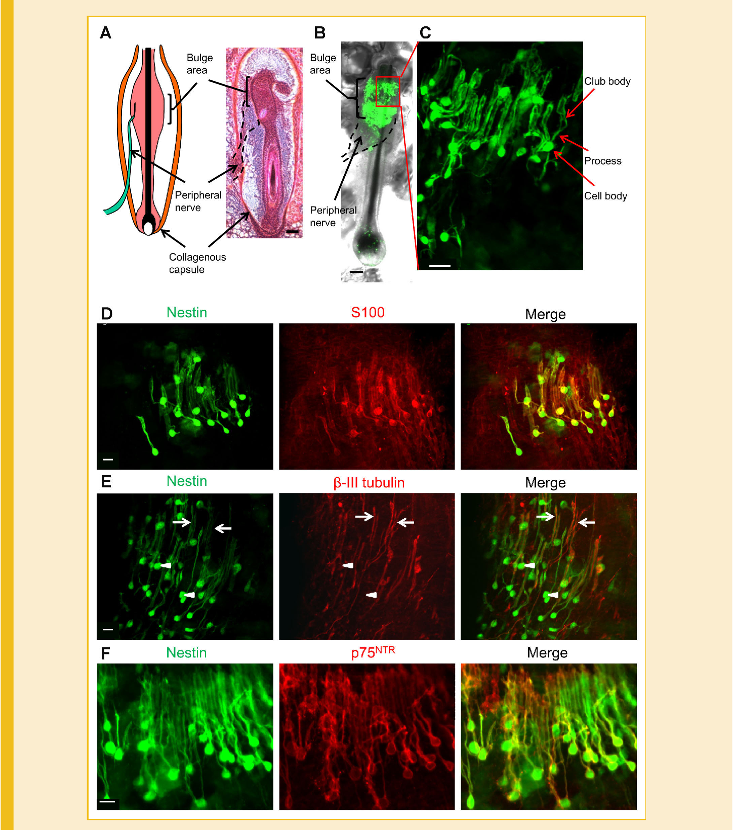 Figure 5 From The Role Of Hair Follicle Nestin Expressing Stem Cells