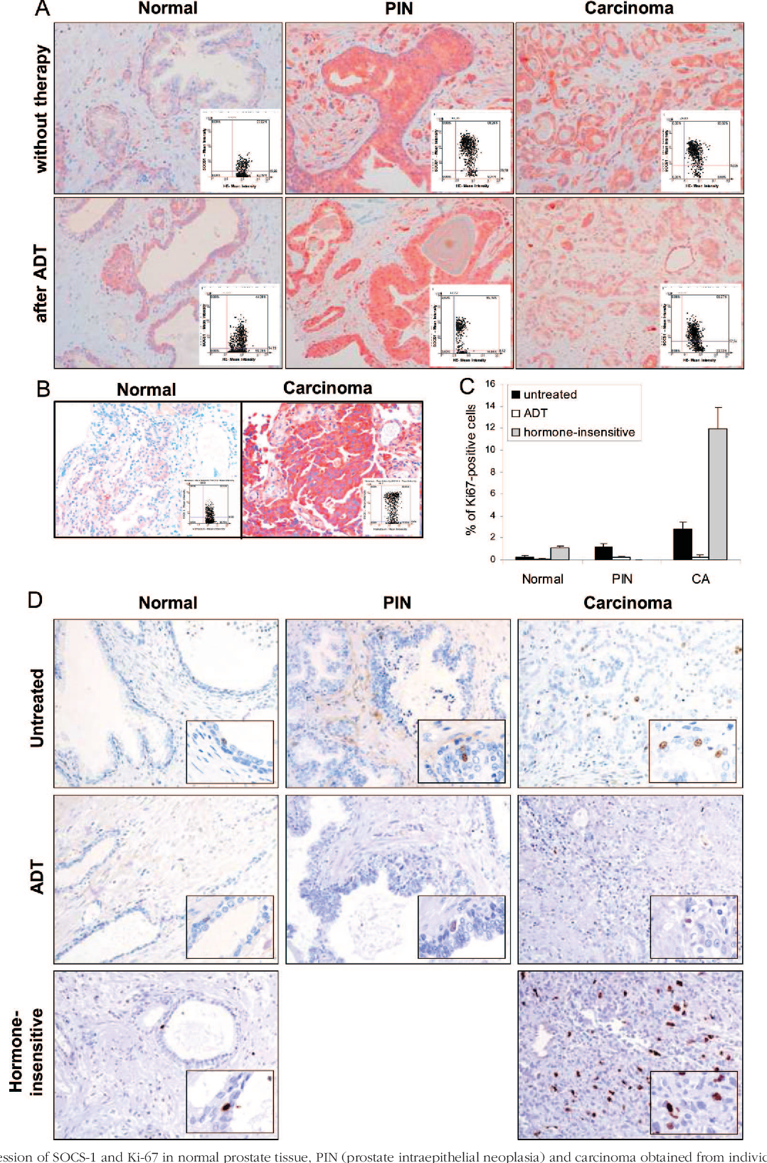 Figure 1 From Suppressor Of Cytokine Signaling Socs 1 Is Expressed In