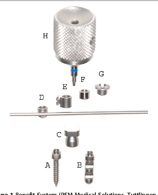 Pdf Maxillary Protraction Using A Hybrid Hyrax Facemask Combination