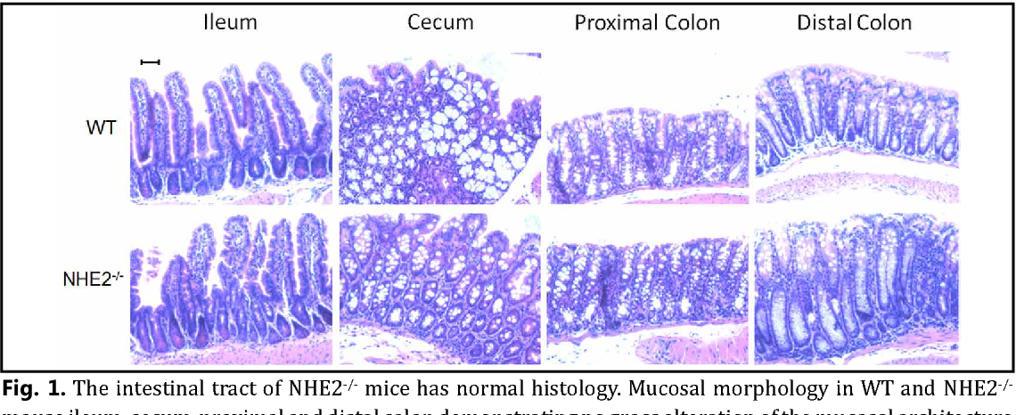 Figure 1 From Acidic Conditions In The Nhe2 Mouse Intestine Result