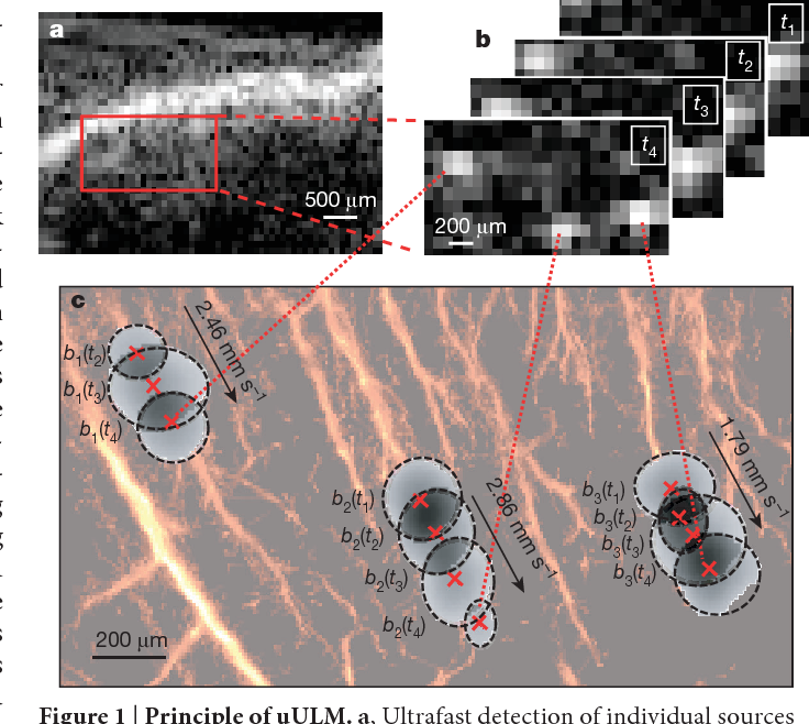 Ultrafast Ultrasound Localization Microscopy For Deep Super Resolution