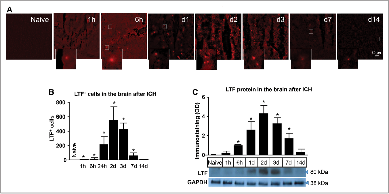 Figure 1 From Beneficial Role Of Neutrophils Through Function Of