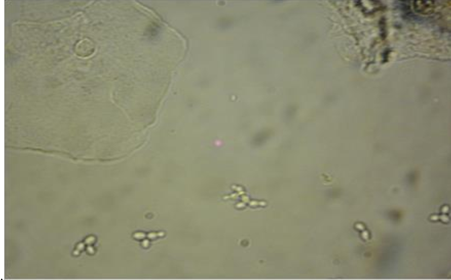 Figure 1 From Identification And Antifungal Susceptibility Pattern Of