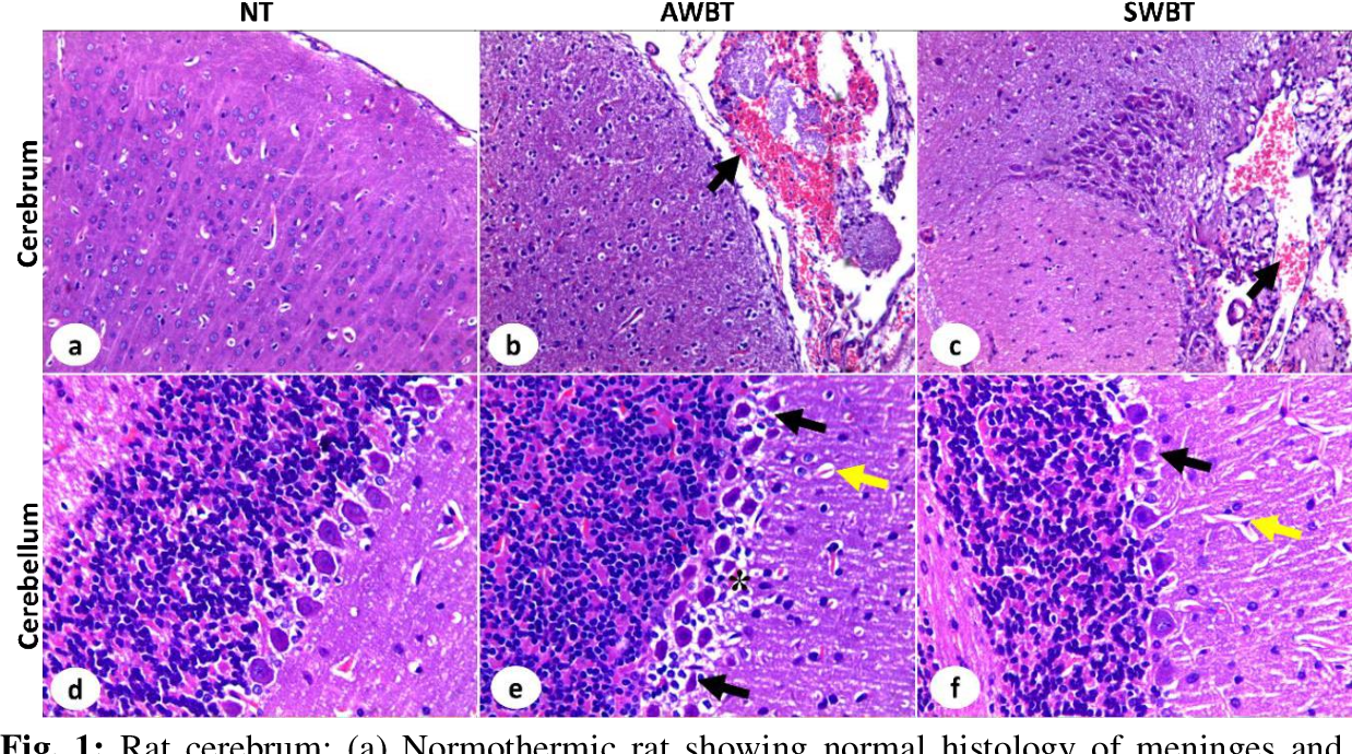 Table 1 From Whole Body Hyperthermia Induced Brain Injury In Rats