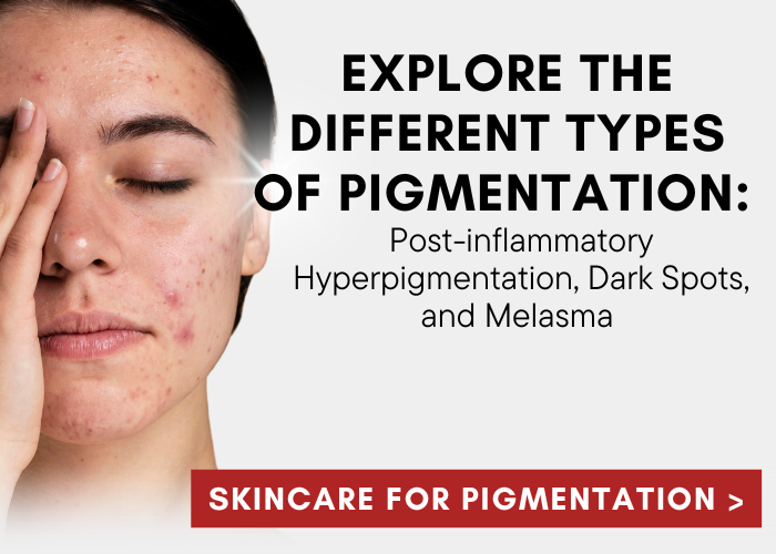 Skin Pigmentation Has Many Types🤔 Nihon Skin