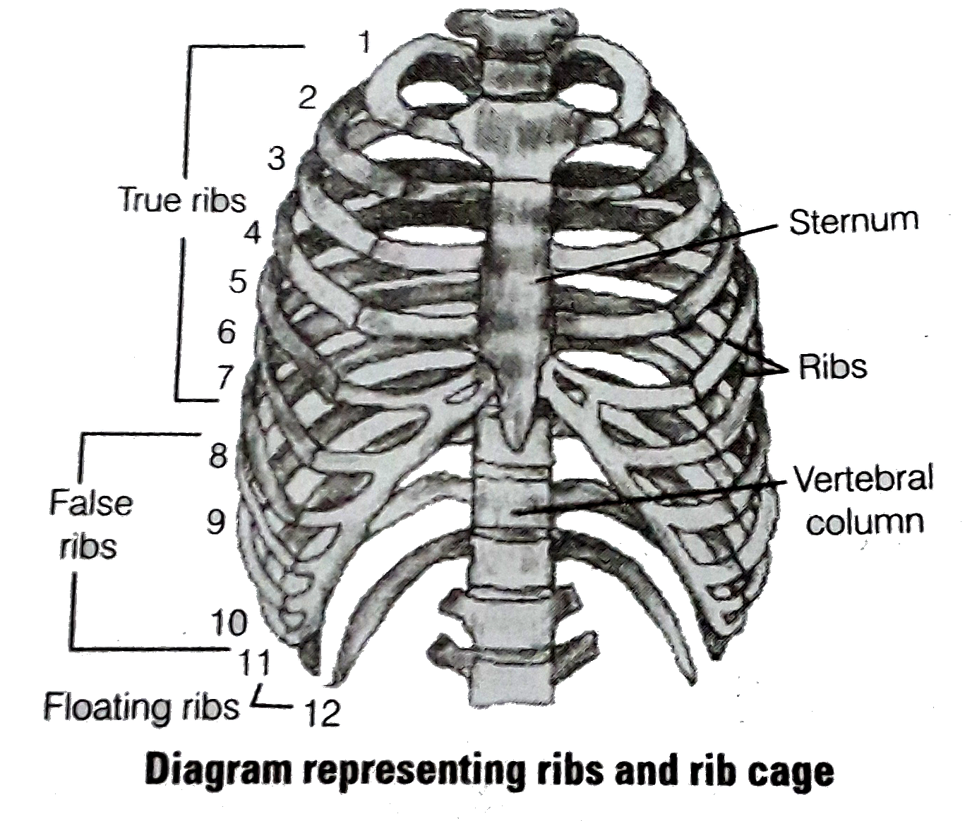 With Respect To Rib Cage Explain The Following Abicephalic Ribs