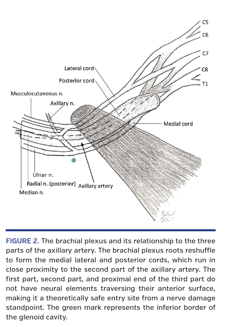 Suggested Bony Landmarks For Safe Axillary Artery Access