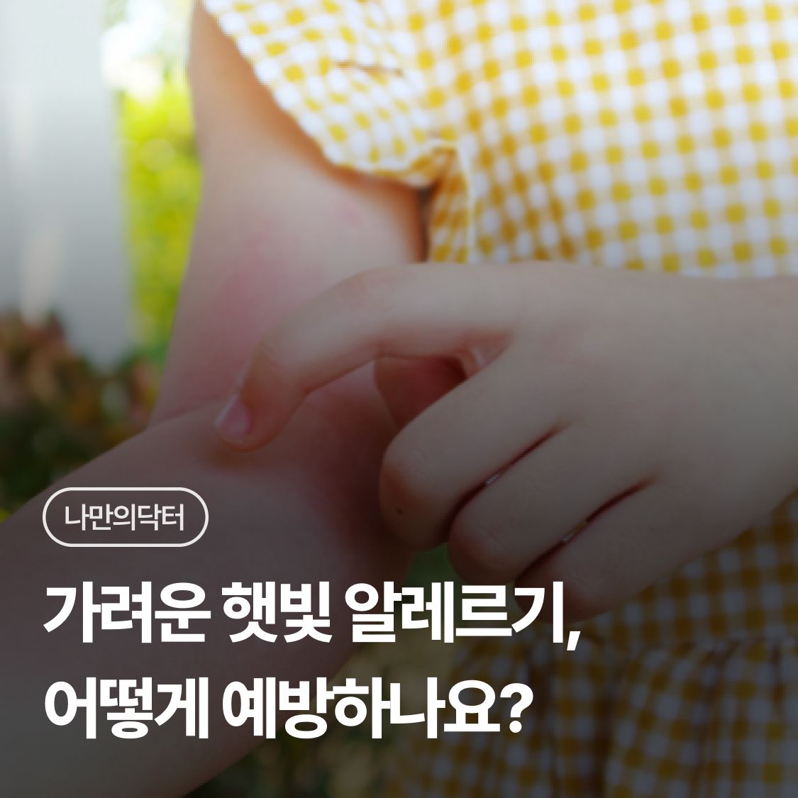 따끔하고 가려운 햇빛 알레르기 원인 및 증상 예방법 치료법까지 나에게 딱 맞는 건강 꿀팁