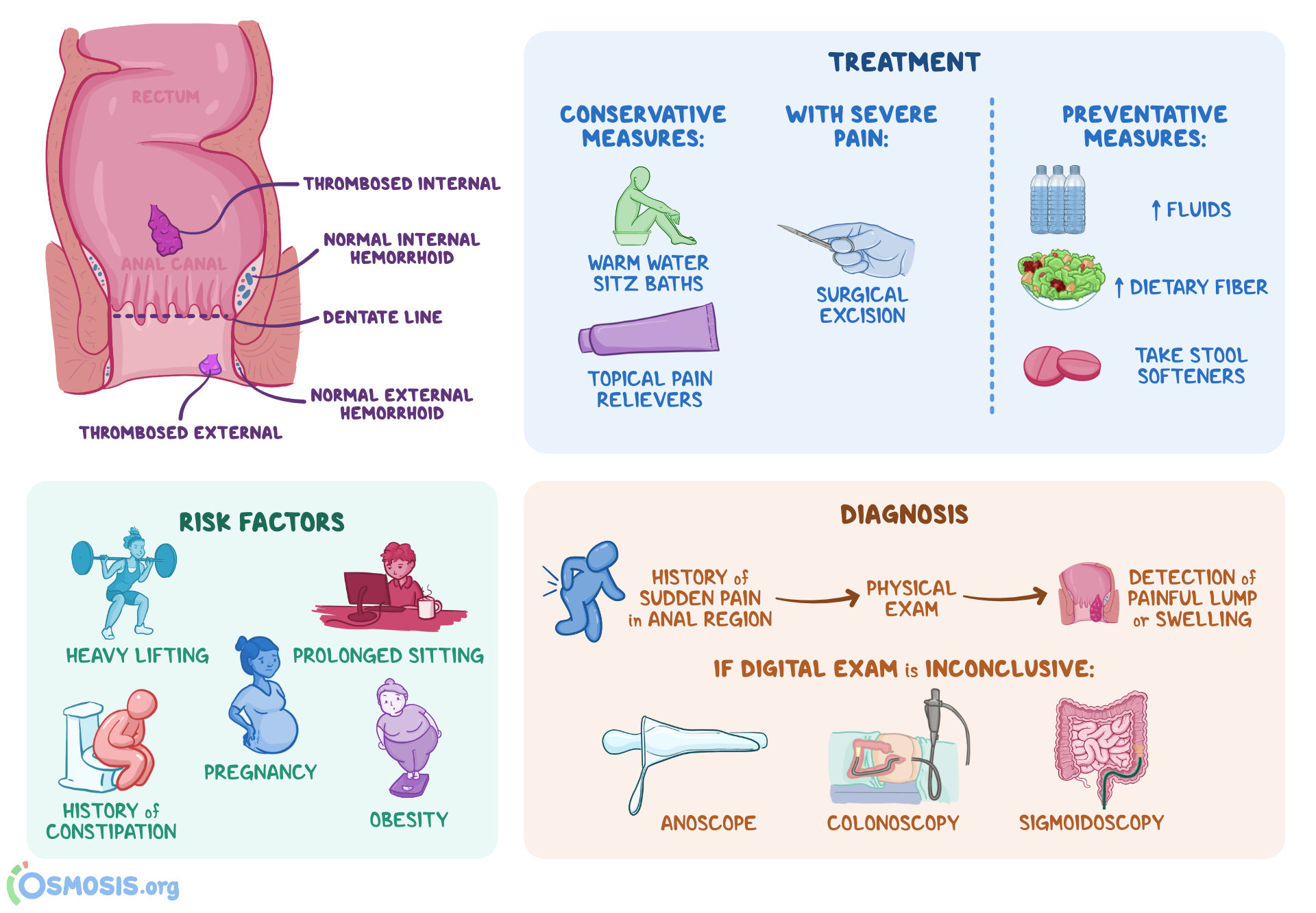 Thrombosed Hemorrhoid What Is It Causes Diagnosis Treatment And