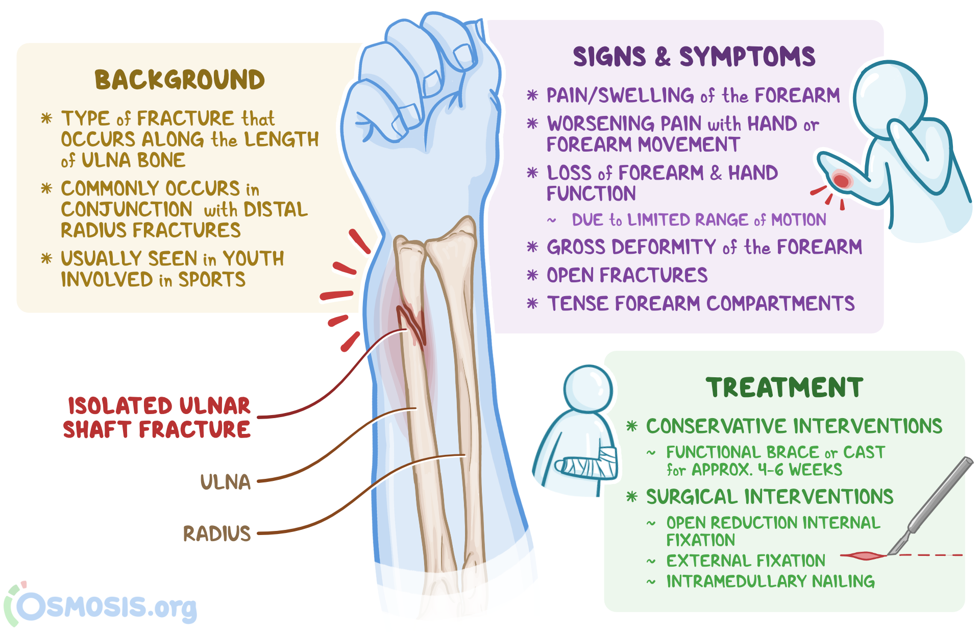 Ulna Hairline Fracture