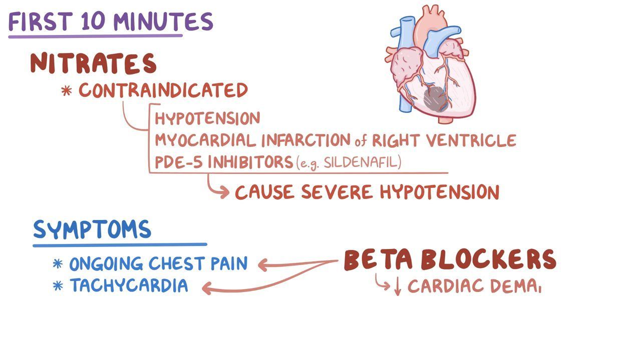 Coronary Artery Disease Clinical Practice Osmosis