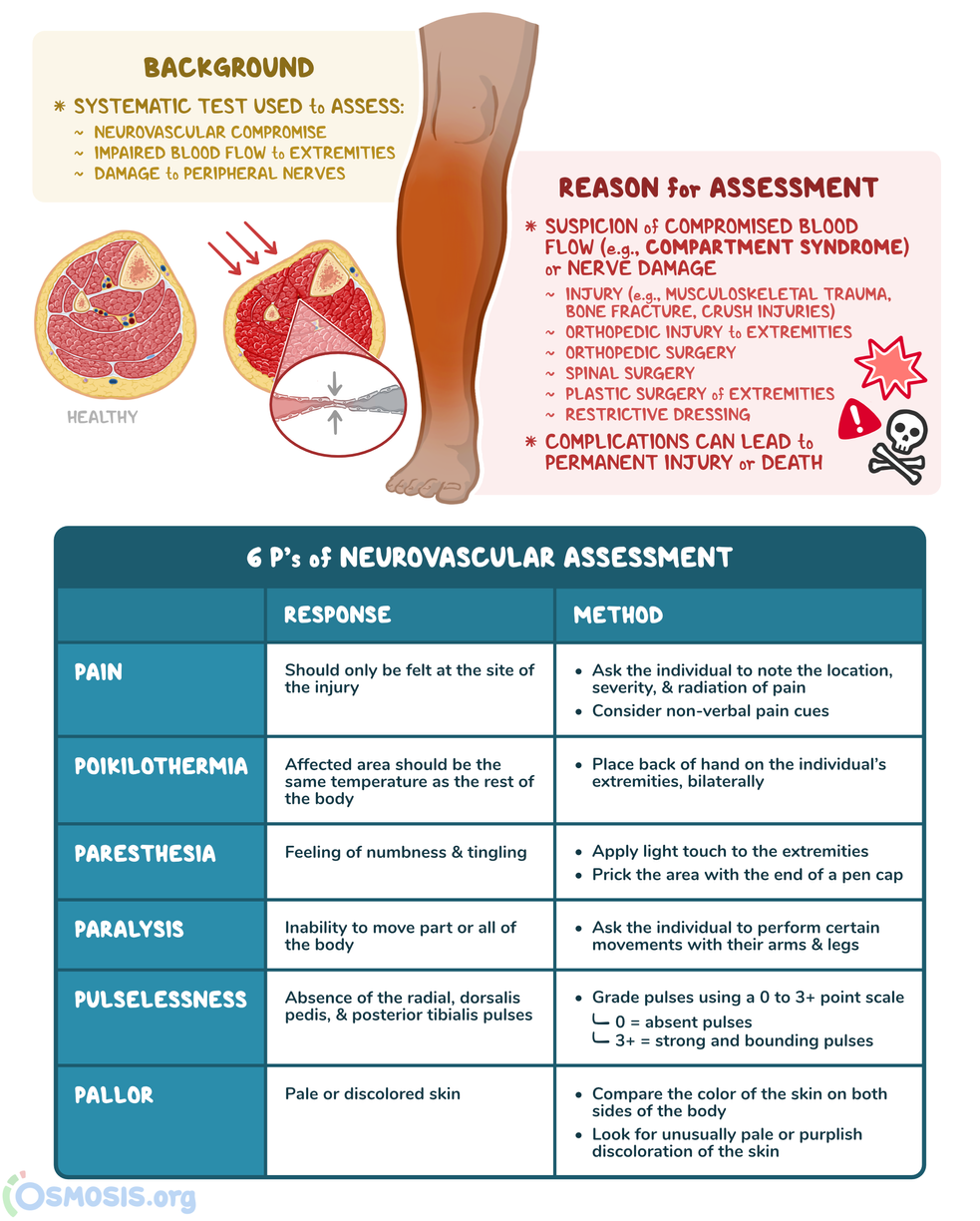 Neurovascular Assessment What Is It Why Its Performed And More