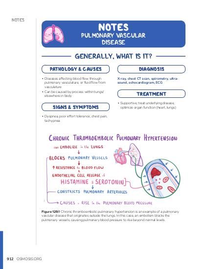 Pulmonary Embolism Video Causes And Meaning Osmosis