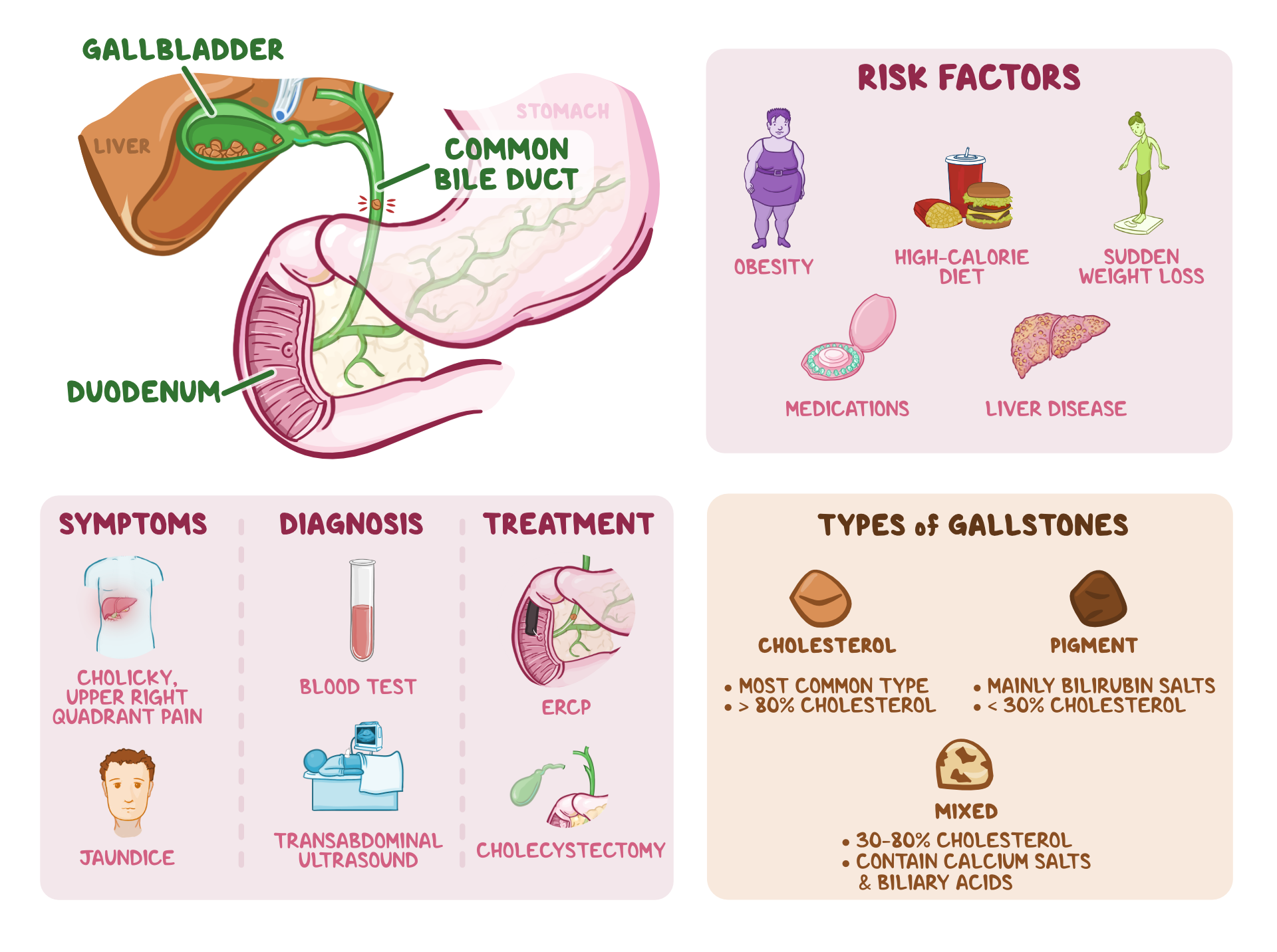 Osmosis Choledocholithiasis What Is It Causes Diagnosis Treatment