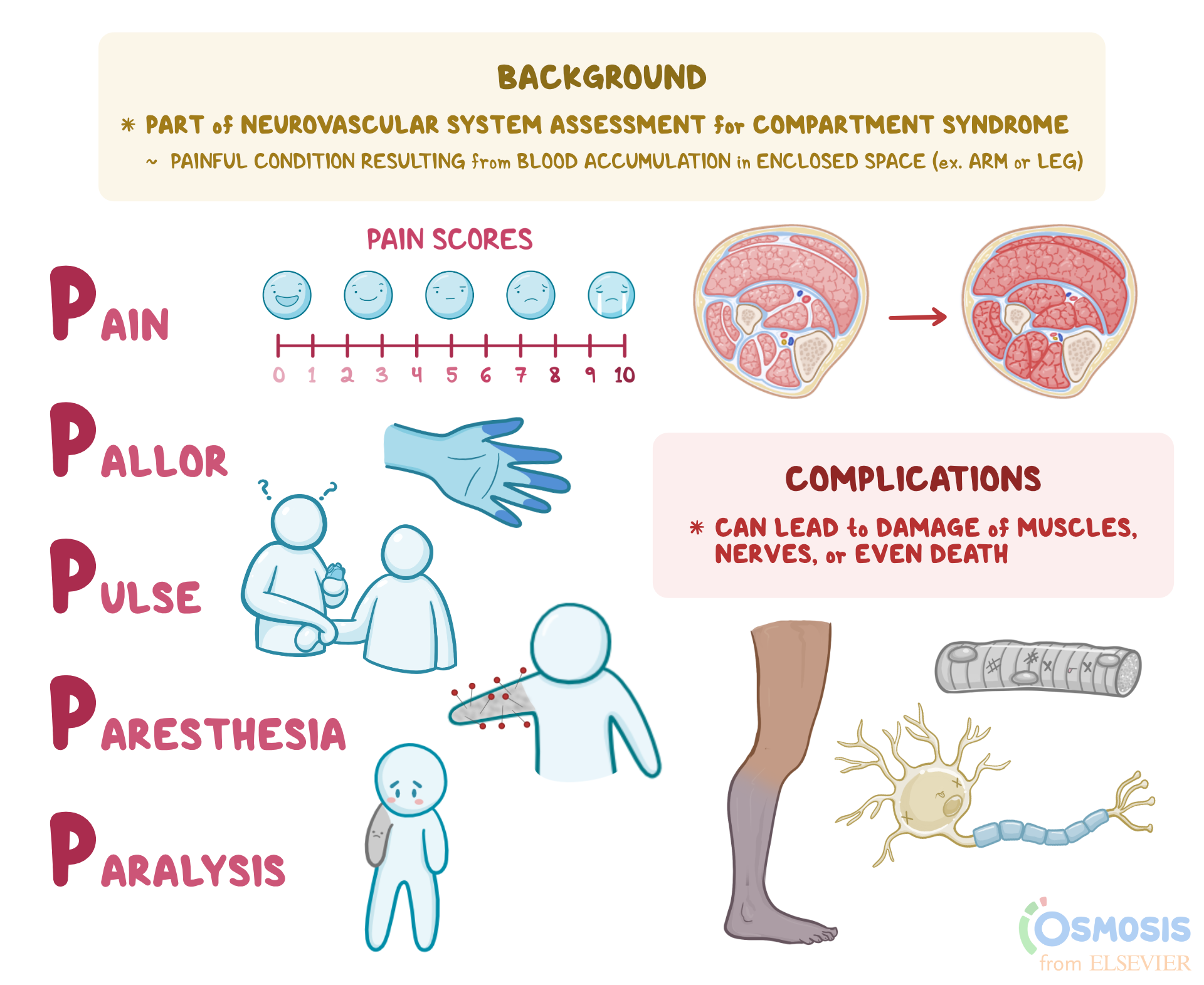 What Is Paresthesia Sign Symptoms Causes And Treatment