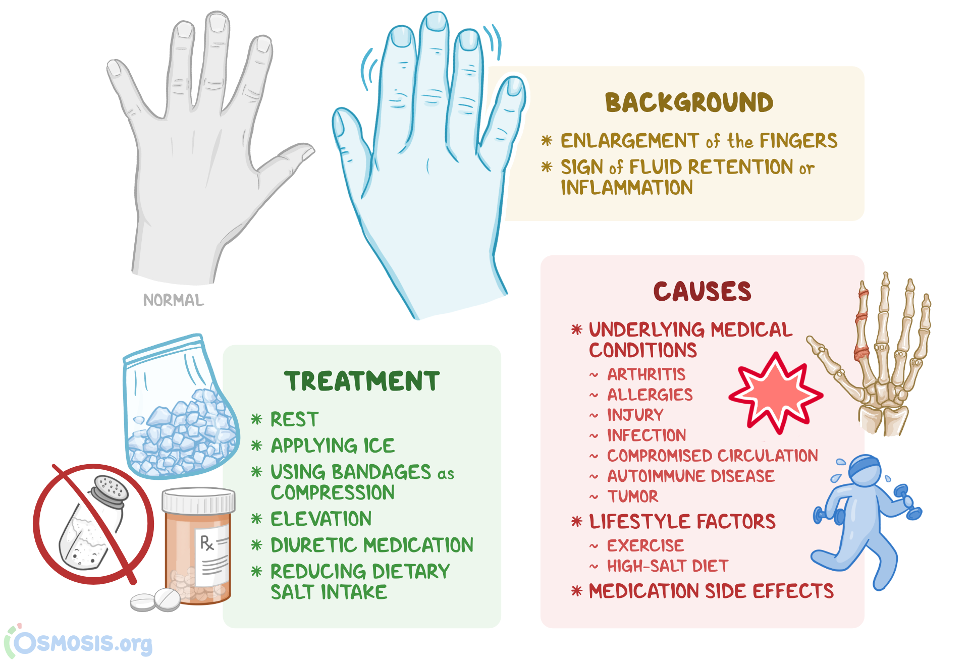 Swollen Fingers What Are They Causes Treatment And More Osmosis