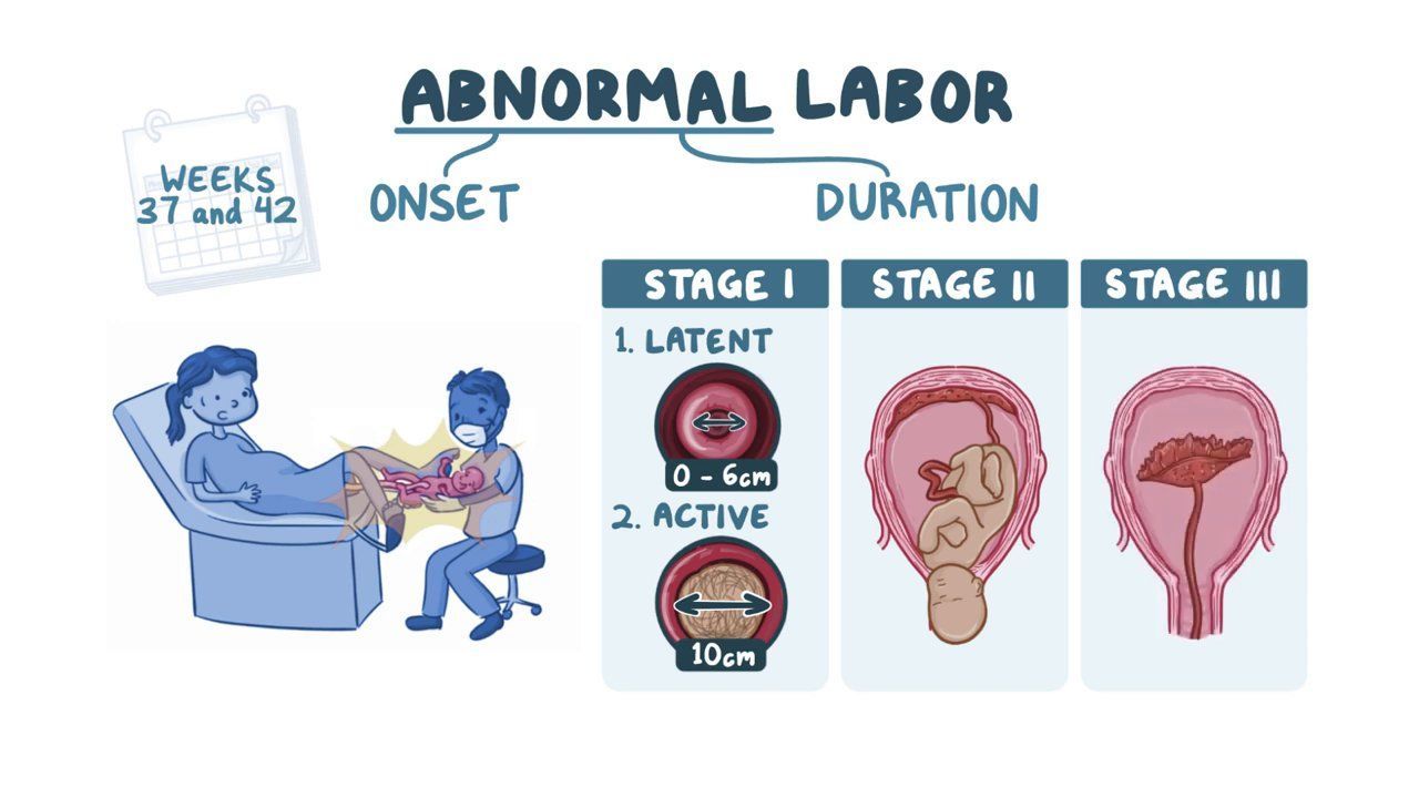 Veal Chop Fetal Heart Rate Patterns Mnemonic Osmosis 58 Off