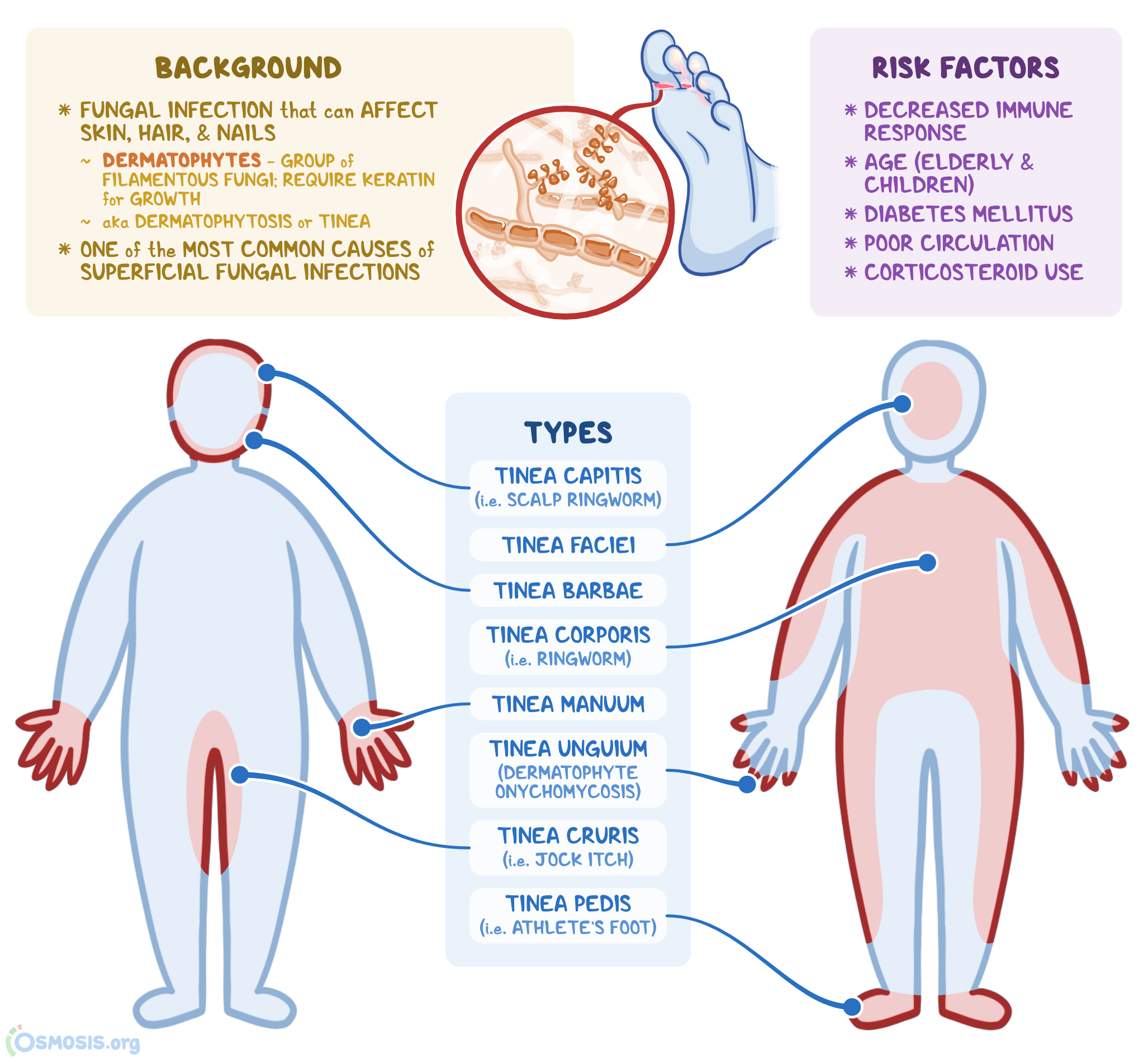 Dermatophyte Infection What Is It Causes Signs And Symptoms