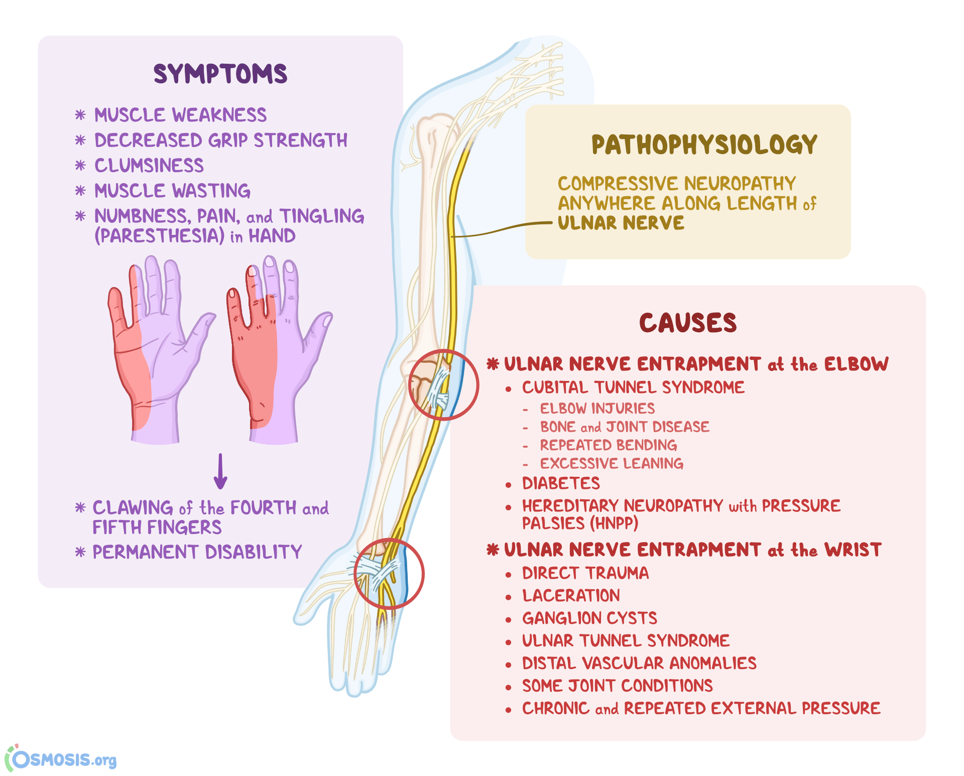 Pdf Anterior Cutaneous Nerve Entrapment Syndrome With