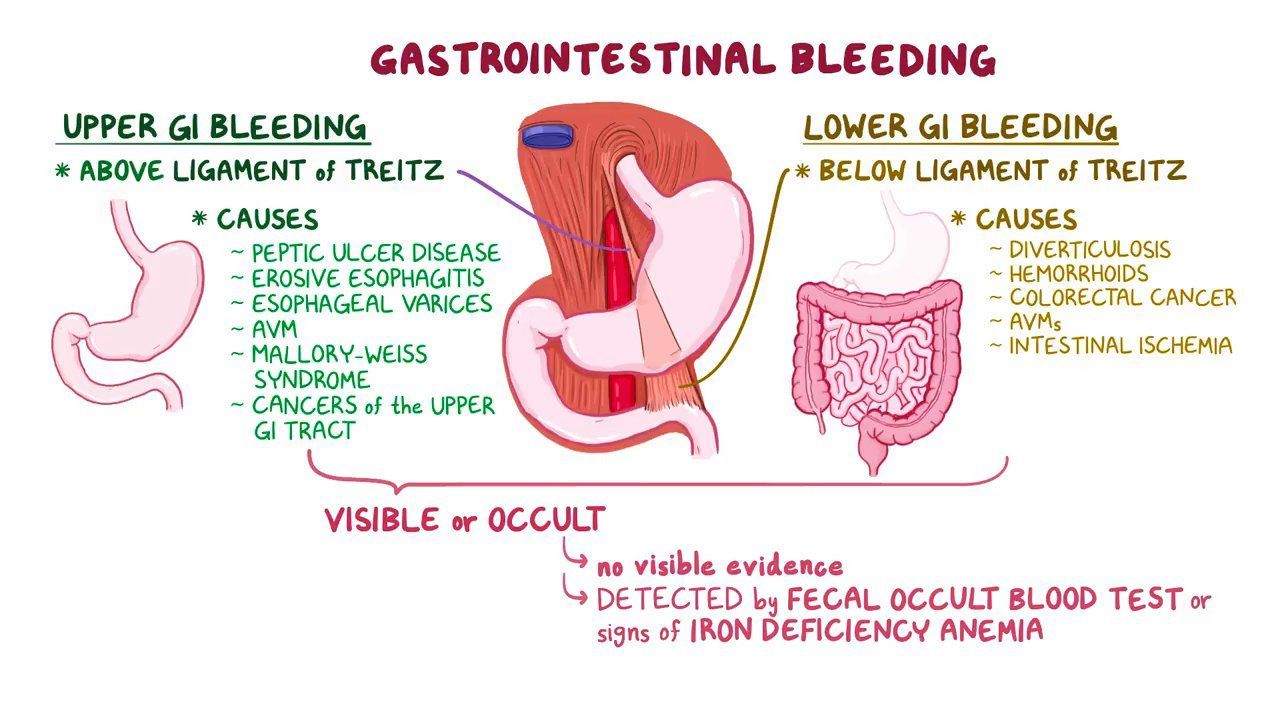 Gastrointestinal Bleeding Clinical Practice Osmosis