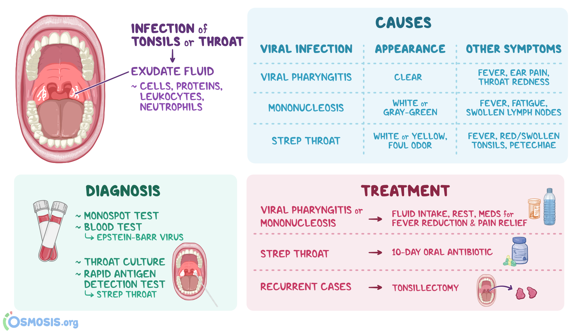 Tonsillar Exudate What Is It Causes Important Facts And More Osmosis