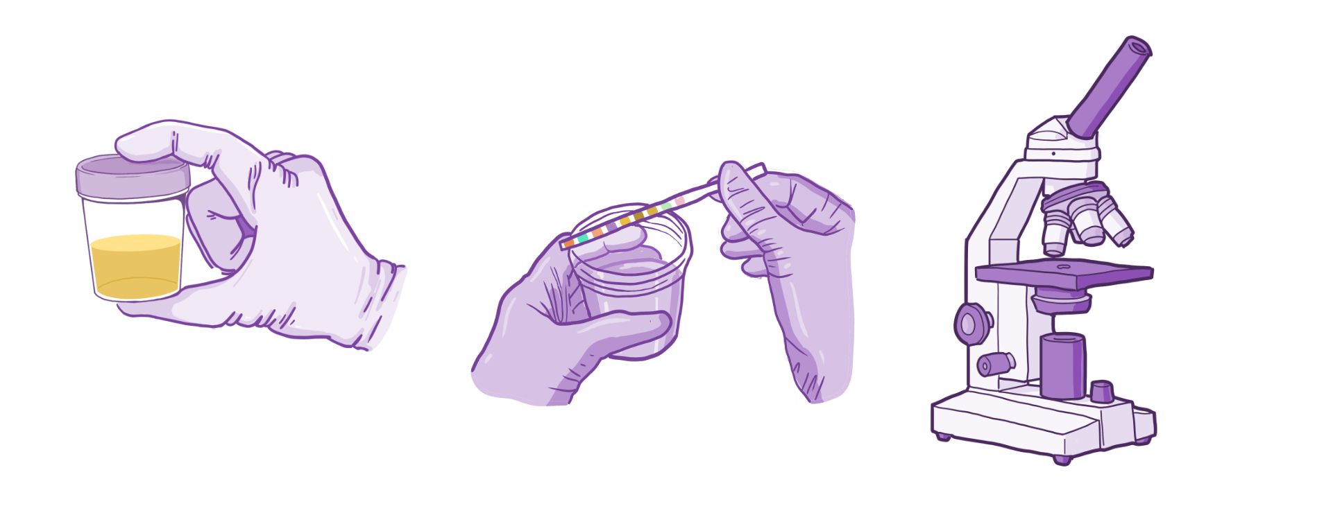 Collecting A Urine Specimen Clinical Skills Notes Osmosis