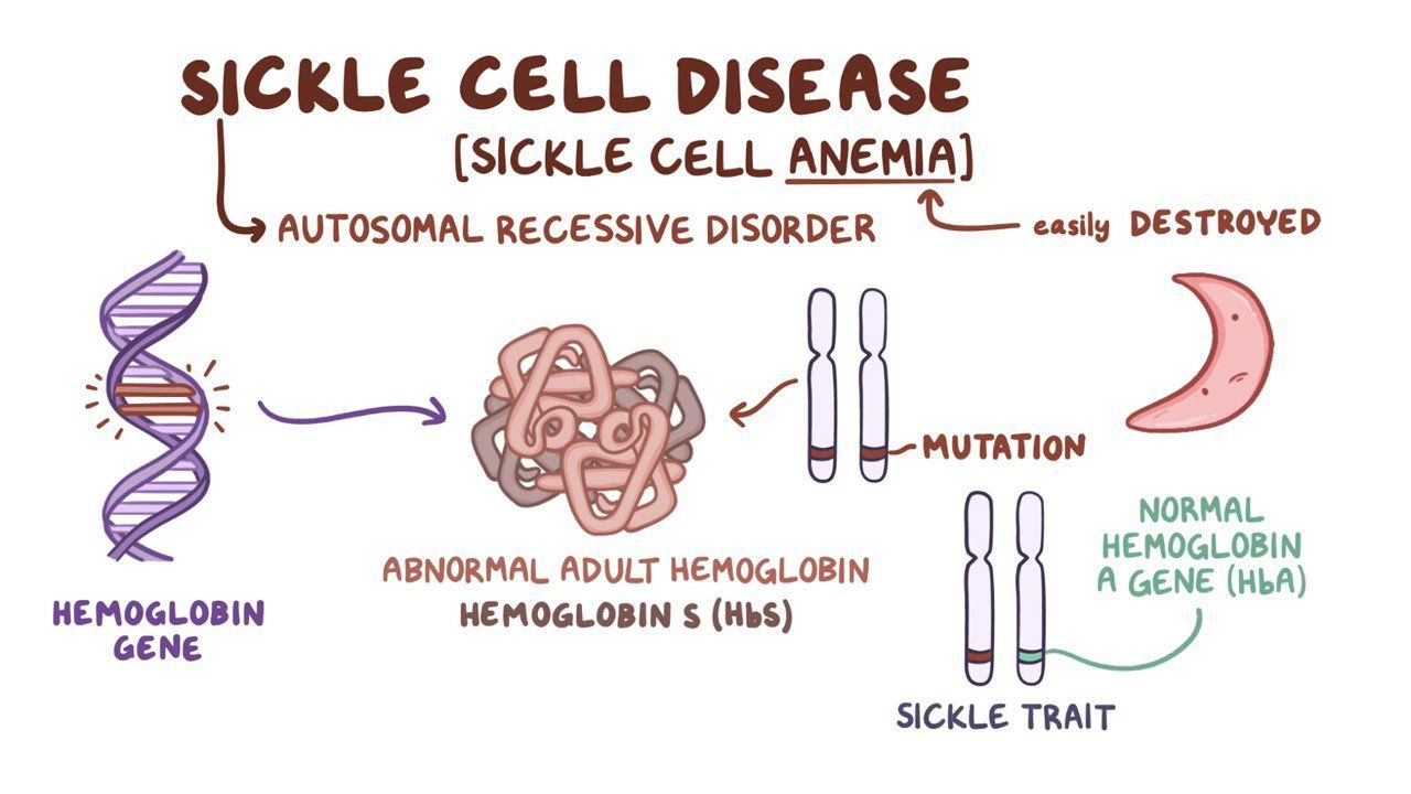 Sickle Cell Disease Clinical Practice Osmosis