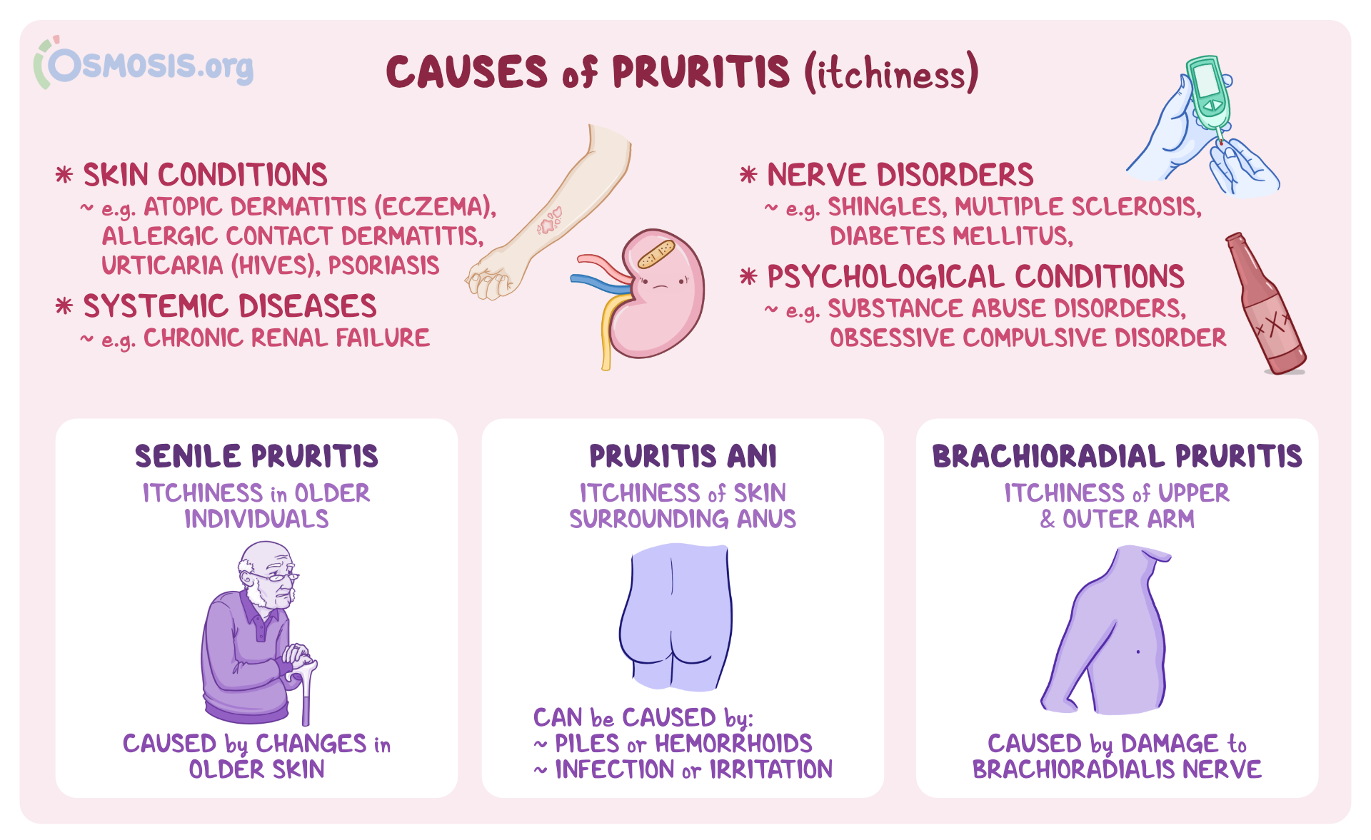 Pruritus Itchy Skin Symptoms Causes Treatment
