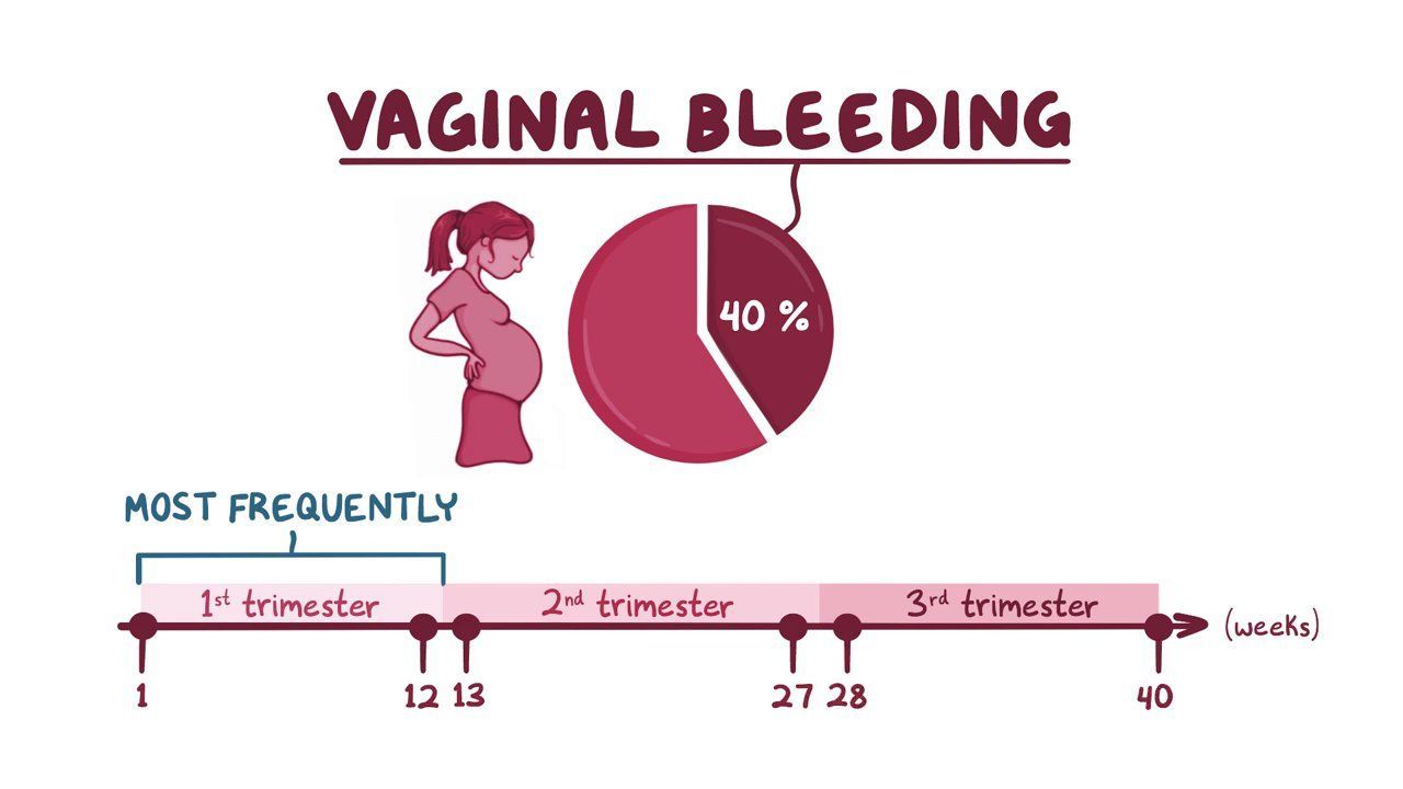 Clinical Reasoning Vaginal Bleeding During Pregnancy Osmosis Hot Sex