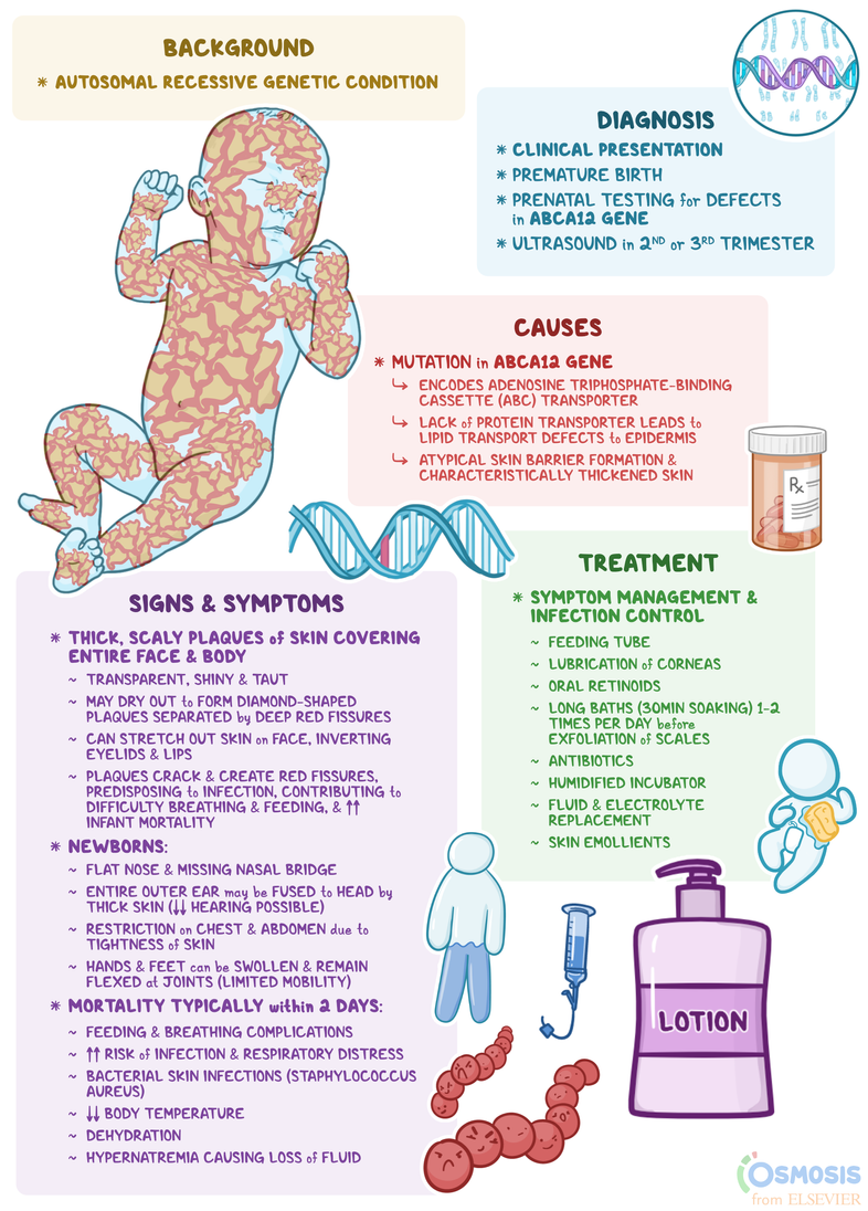 Harlequin Ichthyosis What Is It Causes Signs Symptoms And More