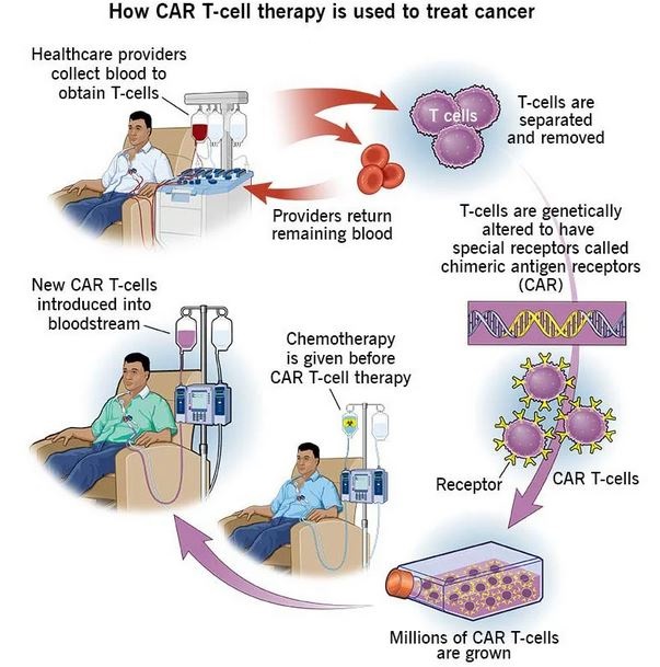 Car T Cell Therapy Approved For Cancer Civilsdaily