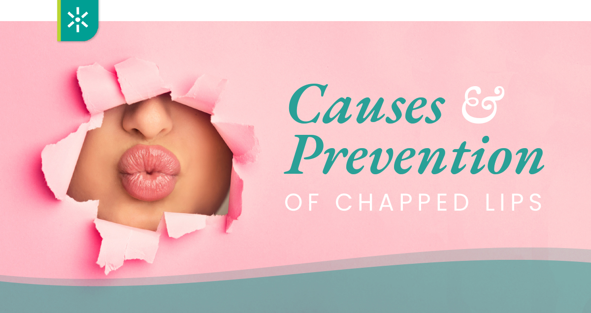 Pucker Up Easy Ways To Prevent Chapped Lips 💋 Beverly Dermatology