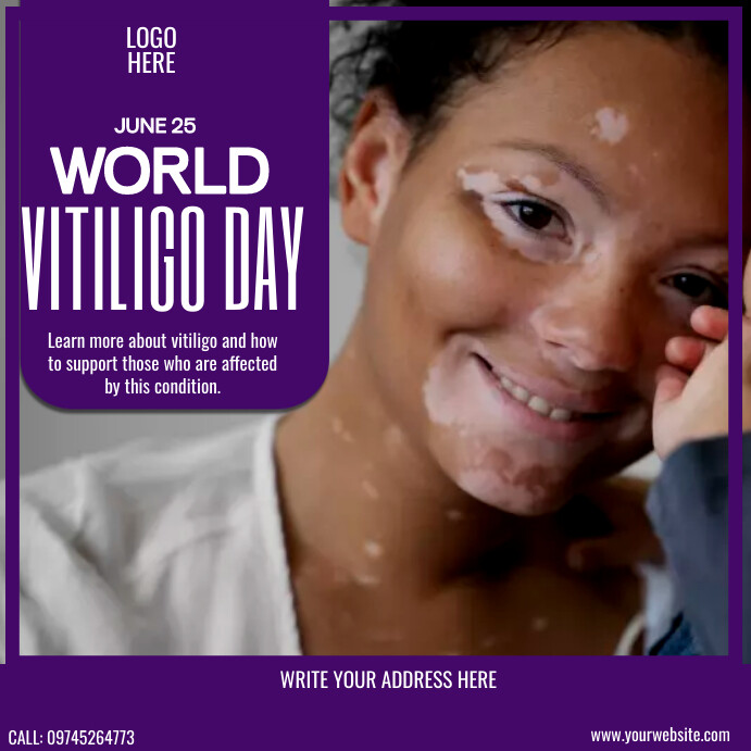 World Vitiligo Day Template Postermywall