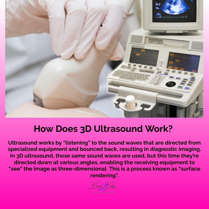 3d Ultrasound Studio Facts Template Postermywall