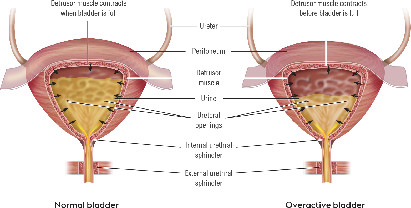 32 Correctly Label The Following Anatomical Parts Of The Male Urethra