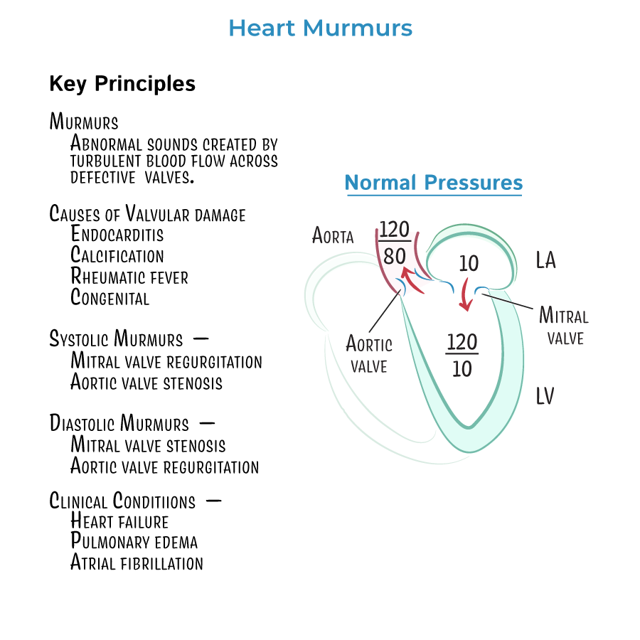 Clinical Pathology Glossary Heart Murmurs Stenosis And Regurgitation