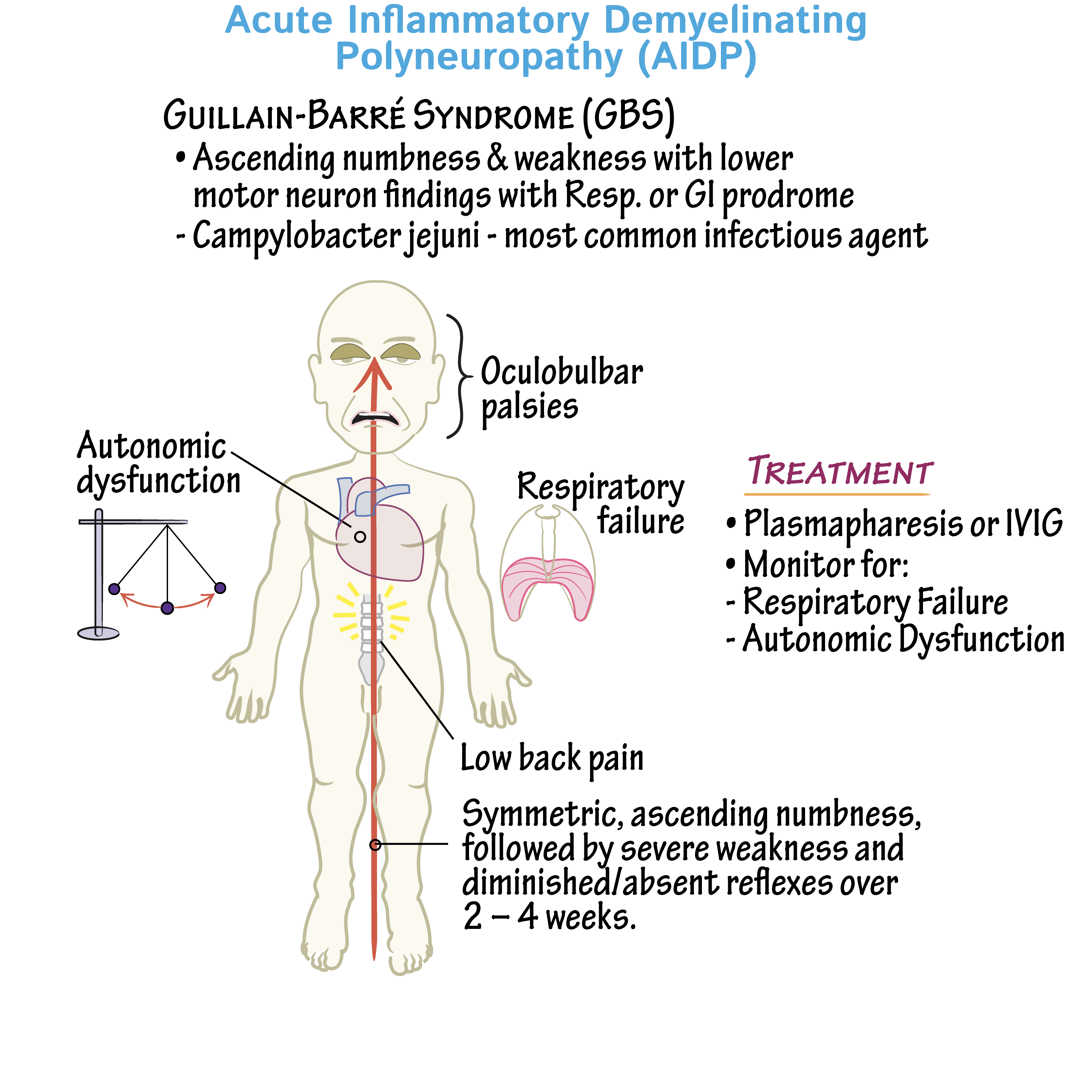 Immunology Microbiology Glossary Guillain Barré Syndrome Ditki