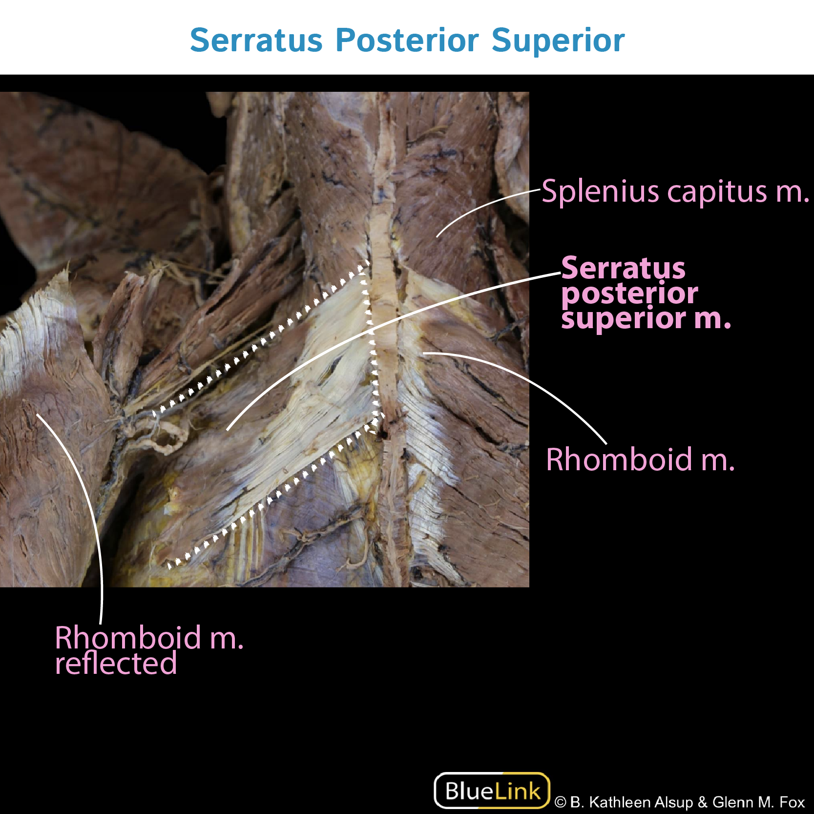 Gross Anatomy Glossary Serratus Posterior Superior Photos Ditki