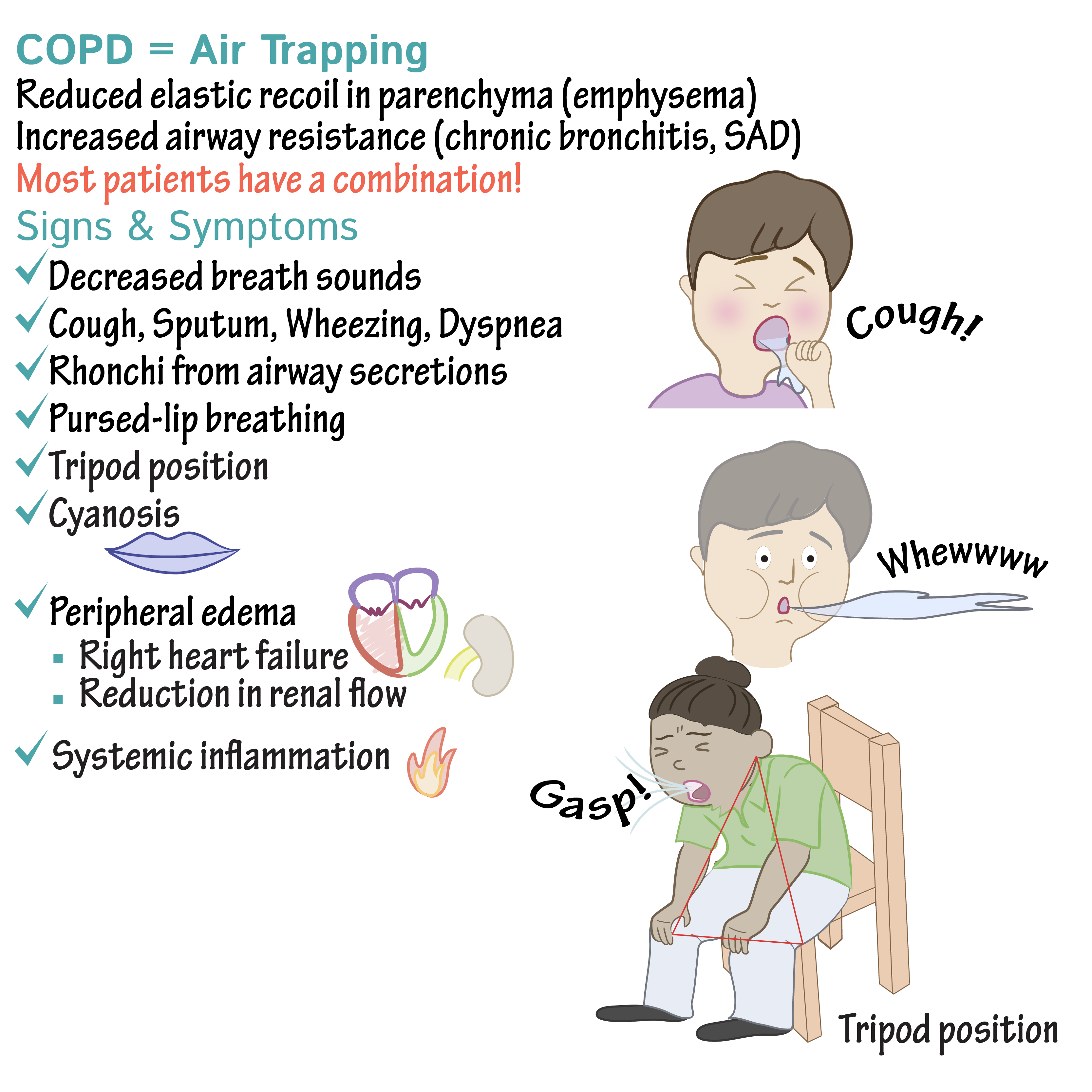 Chronic Obstructive Pulmonary Diseasewhat To Know