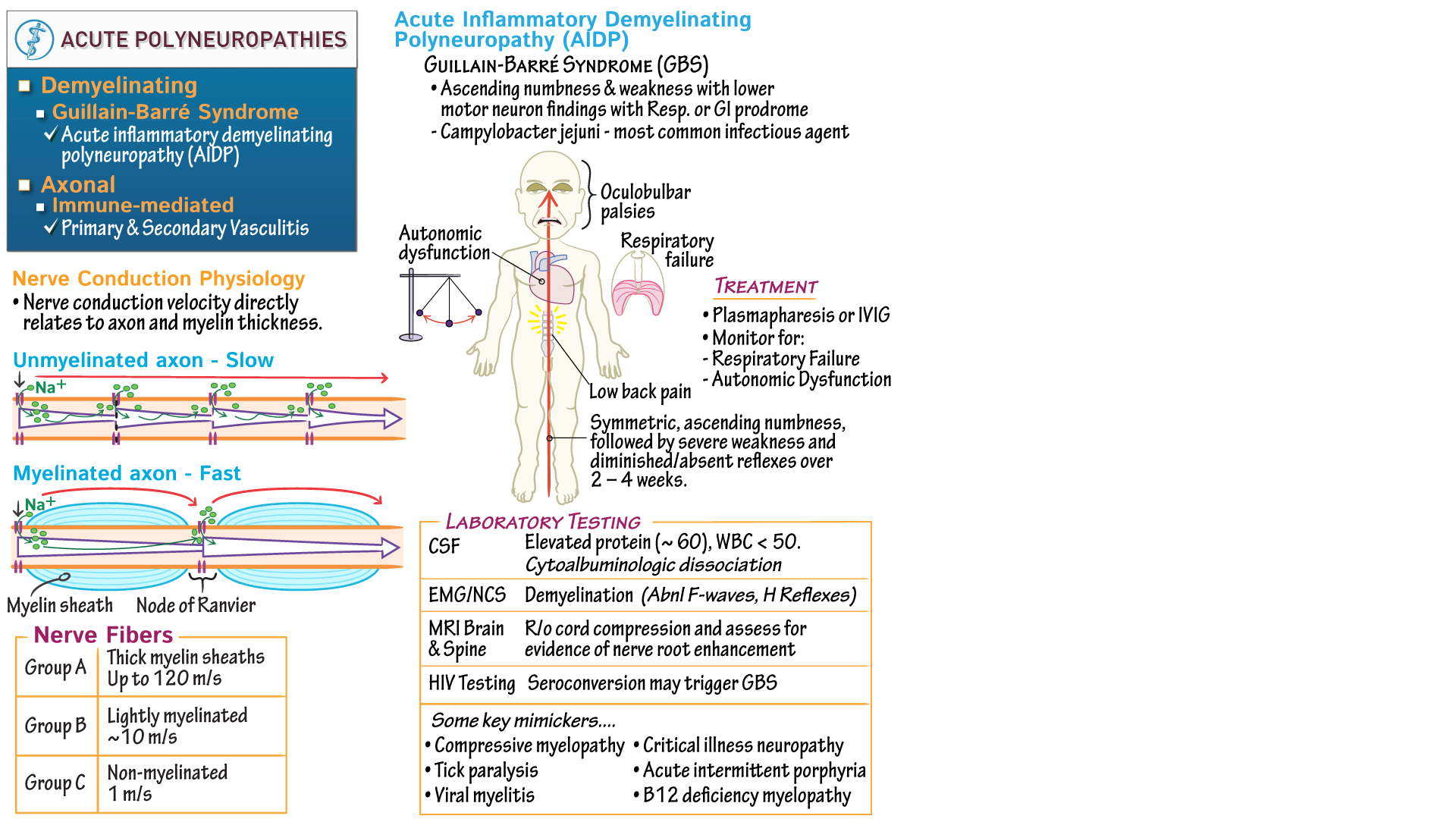 Pathology Guillain Barré Syndrome Draw It To Know It