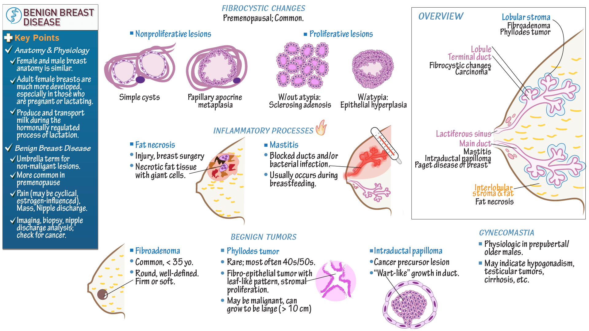 Clinical Pathology Benign Breast Diseases Mastitis Fibrocystic