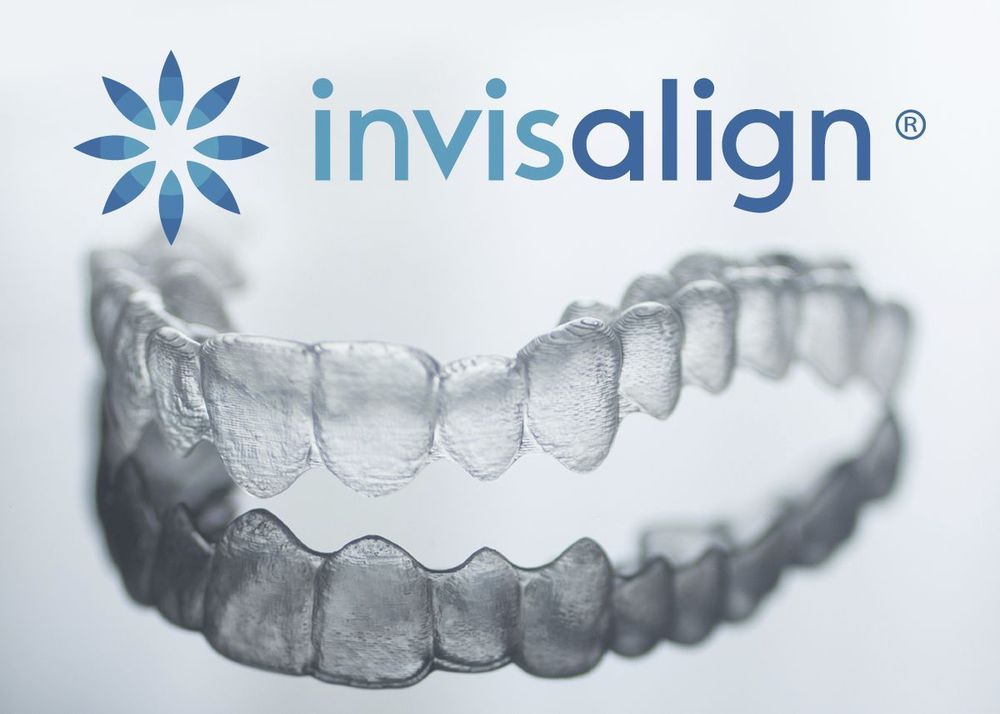 Invisalign Attachmentsbuttons Woodinville Wa Signature Smiles