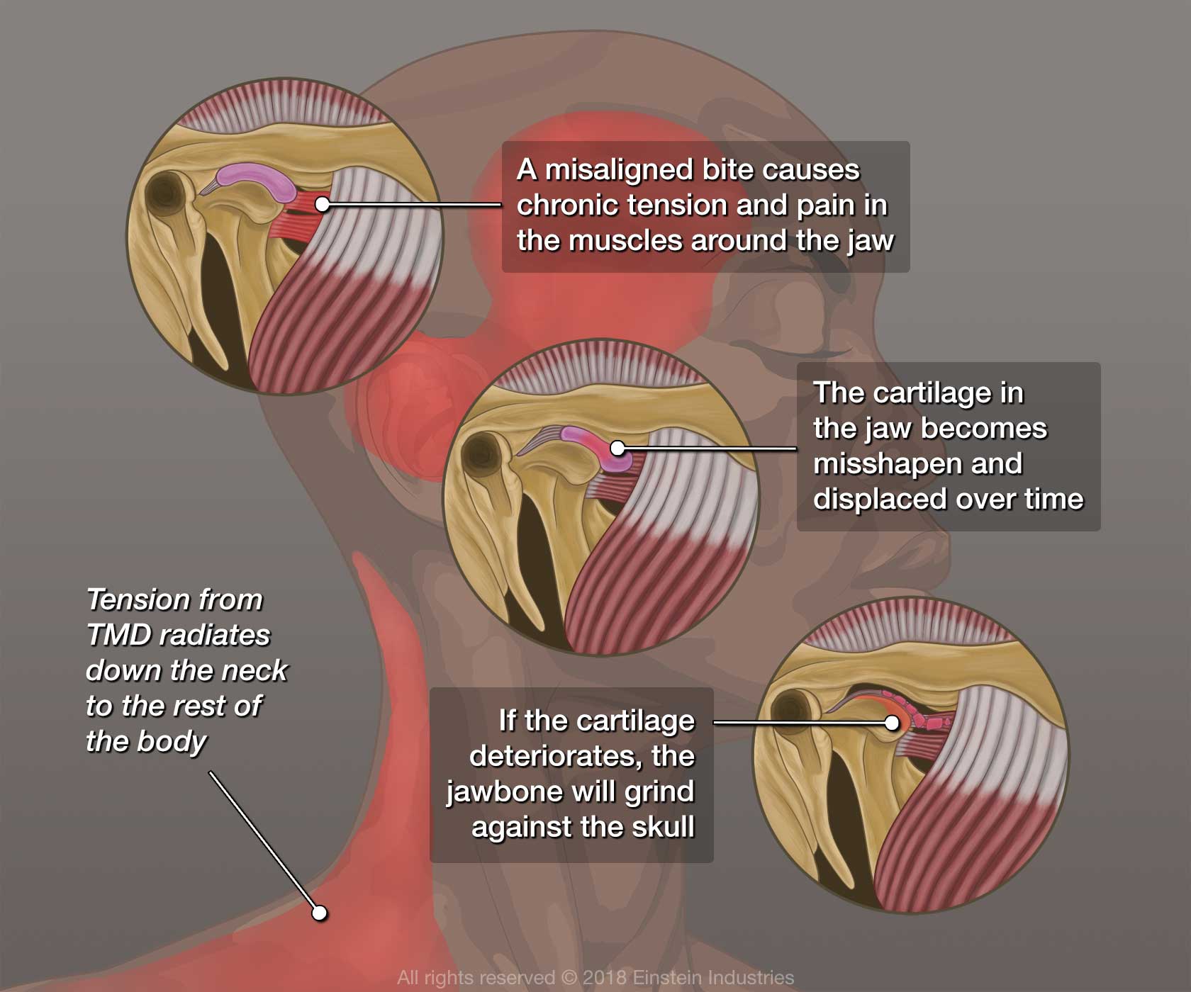 Tmj Nashville Tn Tmj Treatment Gulch Dental Studio