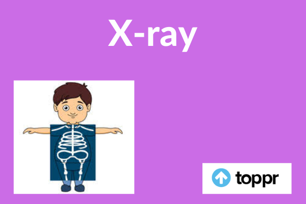 X Ray Definition Properties Types Production And Examples