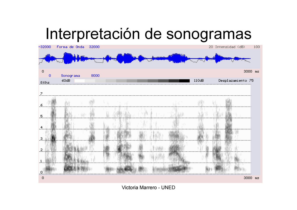 Sonogramas Victoria Interpretación De Sonogramas 1 Entender El