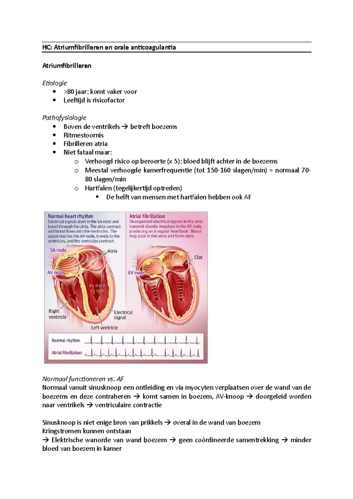 Hc Atriumfibrilleren En Anticoagulantia Kennisclip Hc